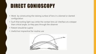 Gonioscopy | PPTX
