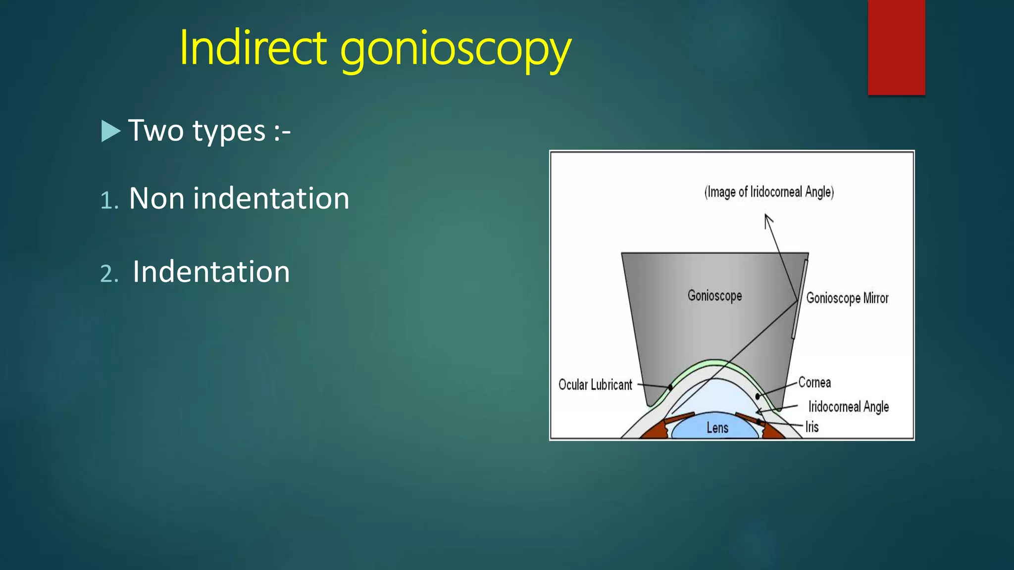 Gonioscopy | PPTX