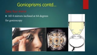Gonioscopy | PPTX