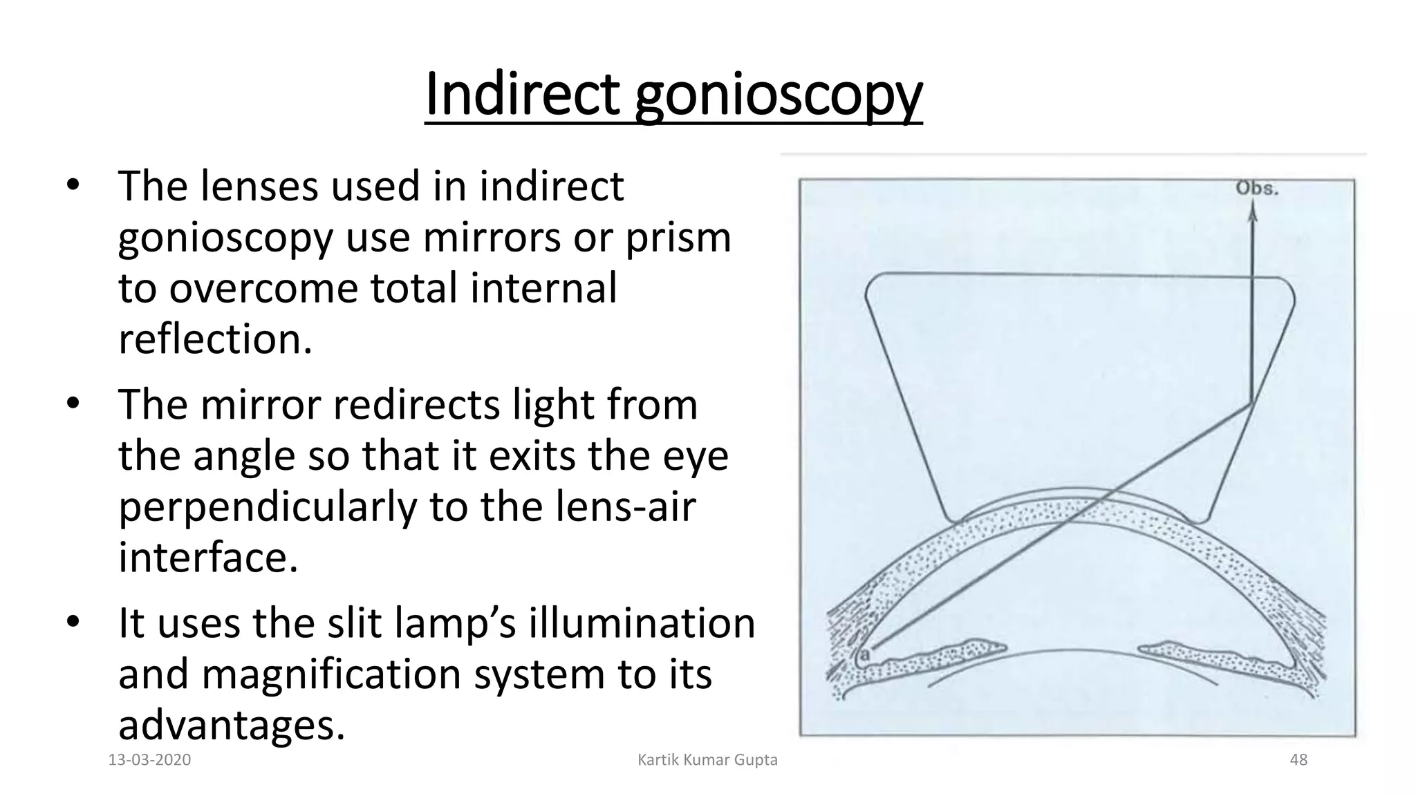Gonioscopy | PPT