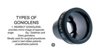 gonioscopy.pptx