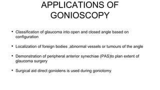 gonioscopy.pptx