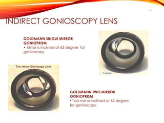 GONIOSCOPY TECHNIQUE AND INVESTIGATION.pptx