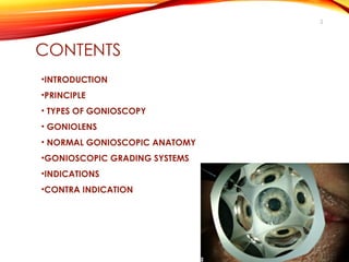 GONIOSCOPY TECHNIQUE AND INVESTIGATION.pptx