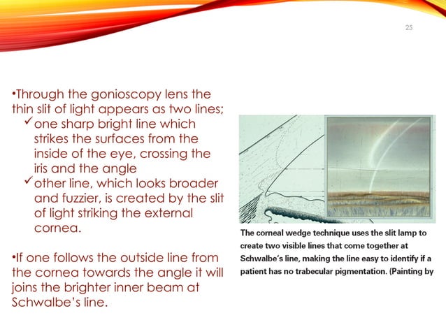 GONIOSCOPY TECHNIQUE AND INVESTIGATION.pptx