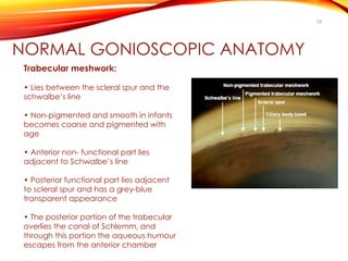 GONIOSCOPY TECHNIQUE AND INVESTIGATION.pptx
