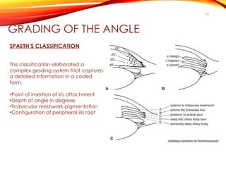 GONIOSCOPY TECHNIQUE AND INVESTIGATION.pptx