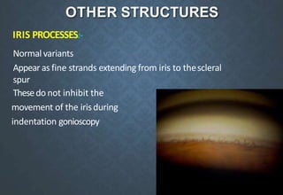 Iris Processes Gonioscopy Angle