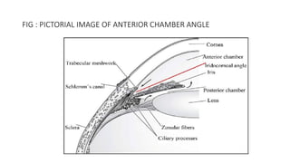 GONIOSCOPY AND ANATOMY OF ANTERIOR CHAMBER.pptx