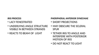 GONIOSCOPY AND ANATOMY OF ANTERIOR CHAMBER.pptx