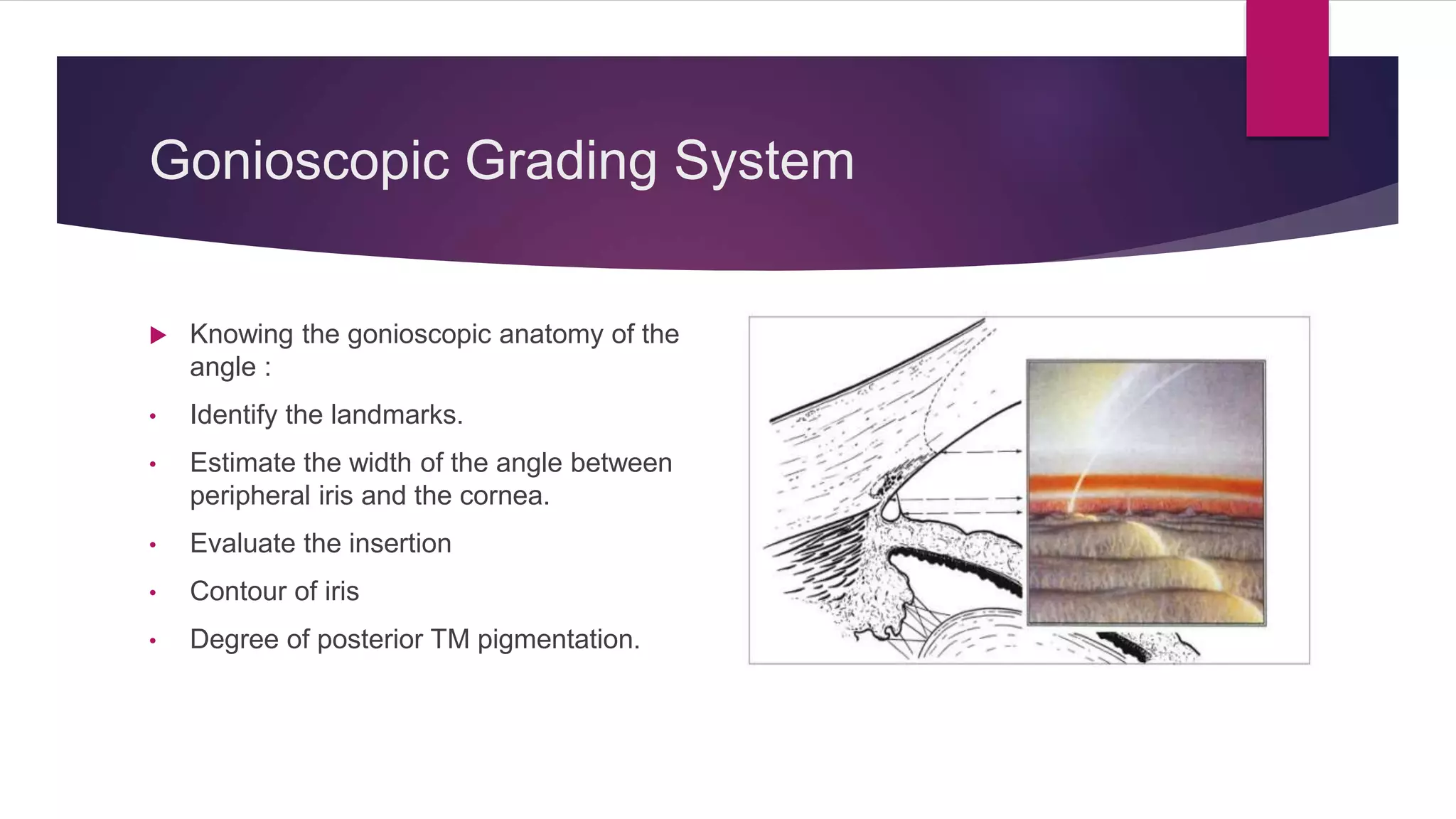 Gonioscopy and methods to assess anterior segments | PPTX