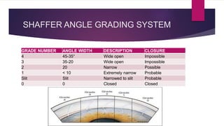 Gonioscopy and methods to assess anterior segments | PPTX