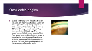 Gonioscopy and methods to assess anterior segments | PPTX