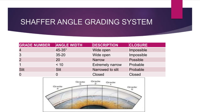 Gonioscopy and methods to assess anterior segments
