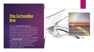 Gonioscopy and optic nerve head evaluation | PPTX