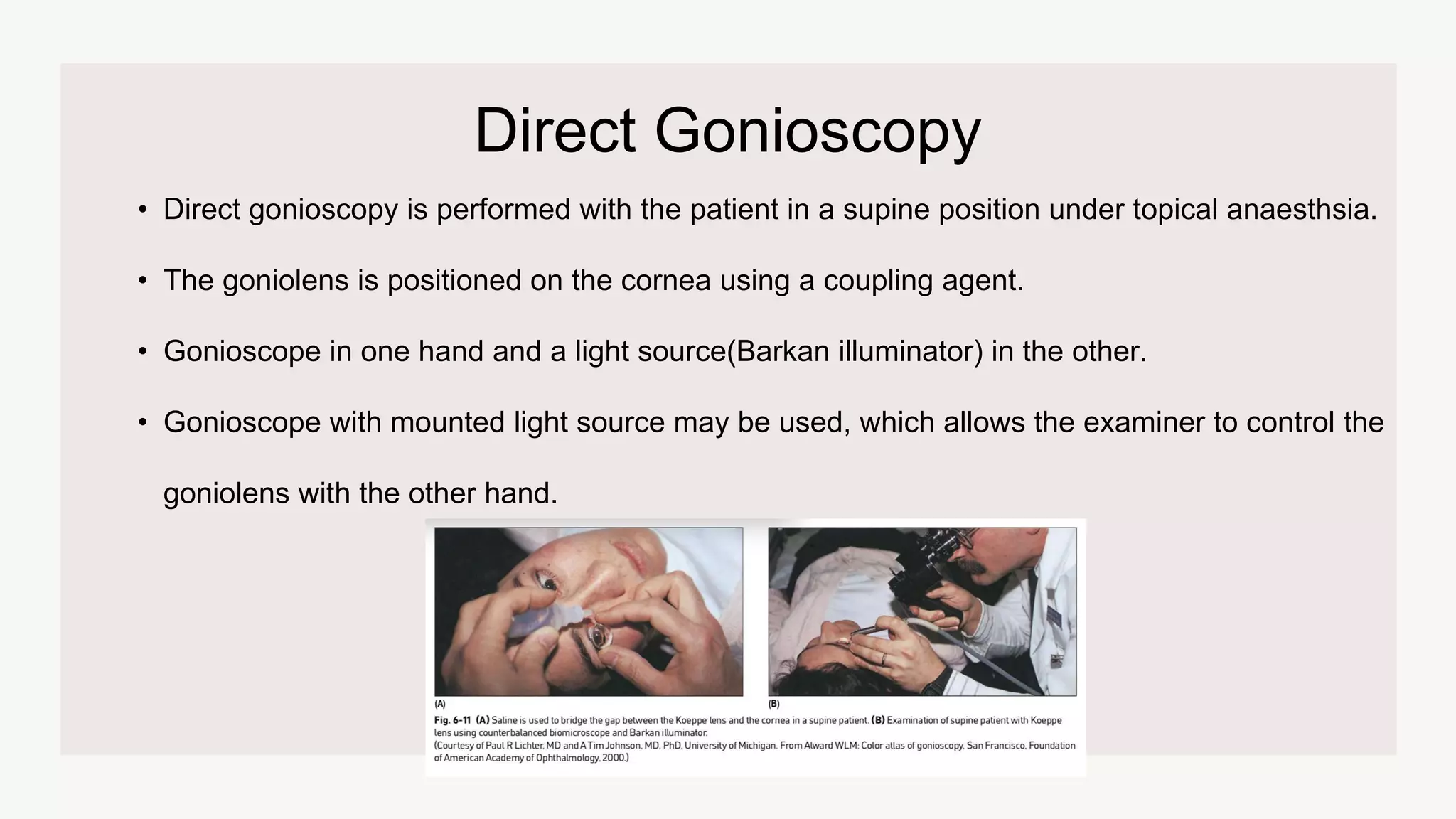 Gonioscopy | PPTX