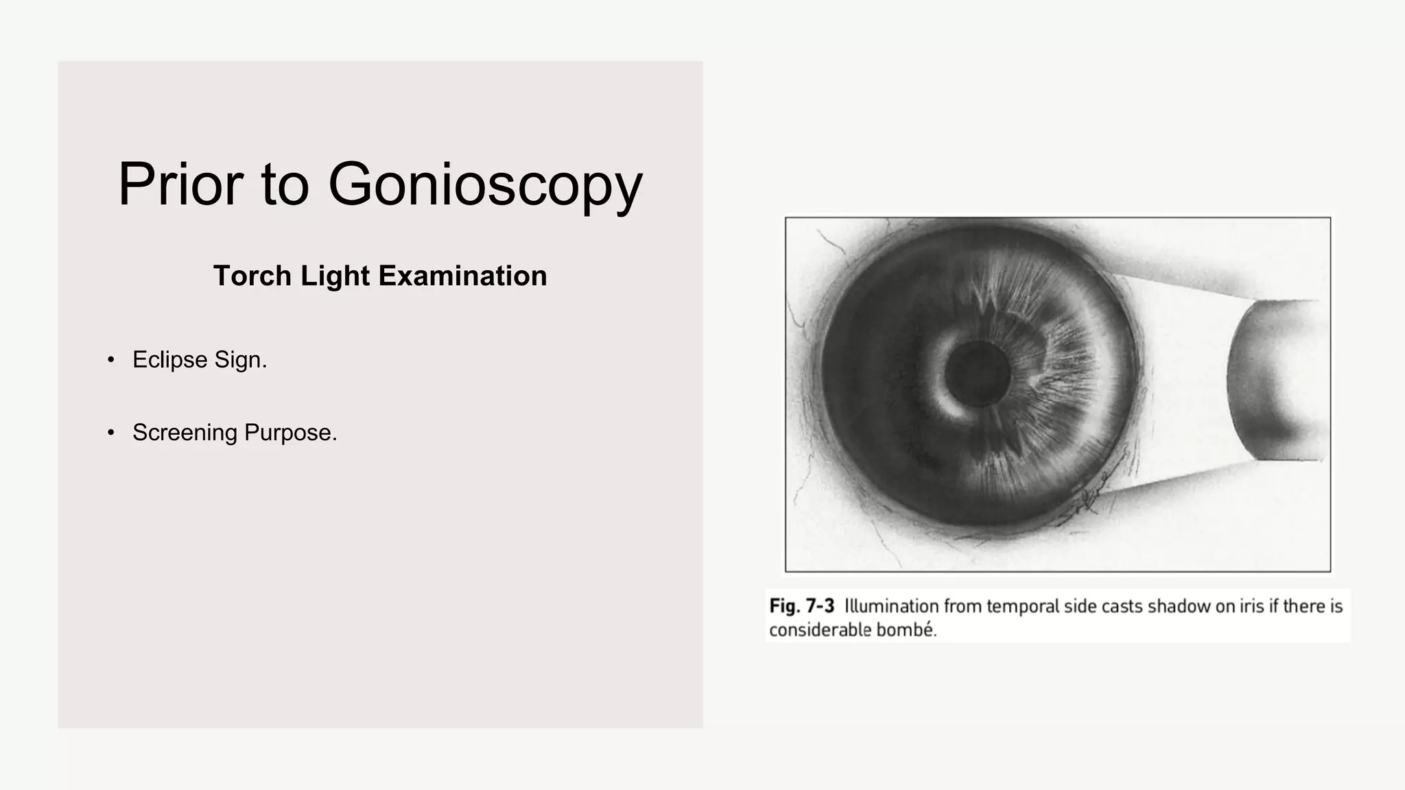 Gonioscopy | PPTX