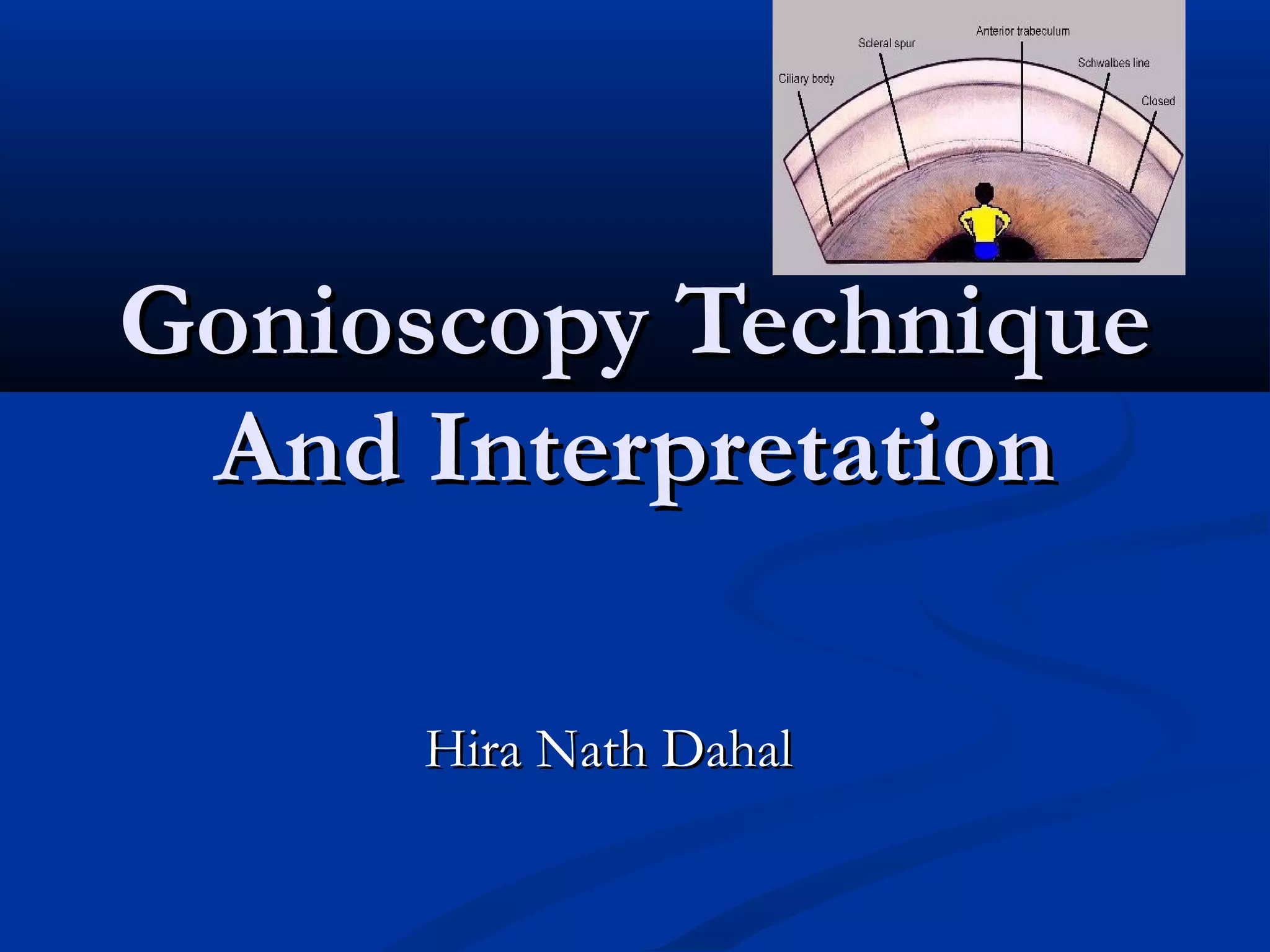 Gonioscopy presentation | PPT