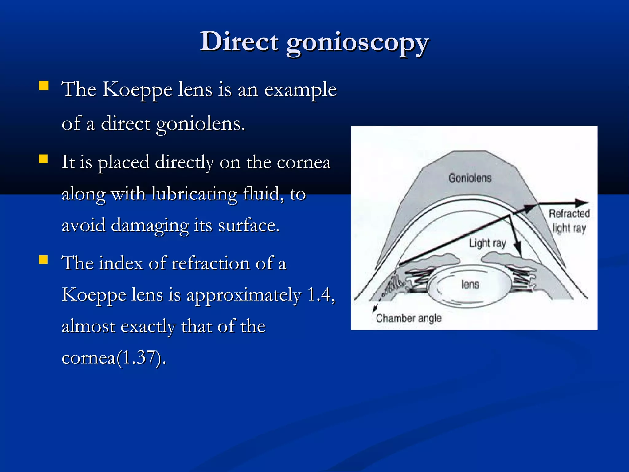 Gonioscopy presentation | PPT