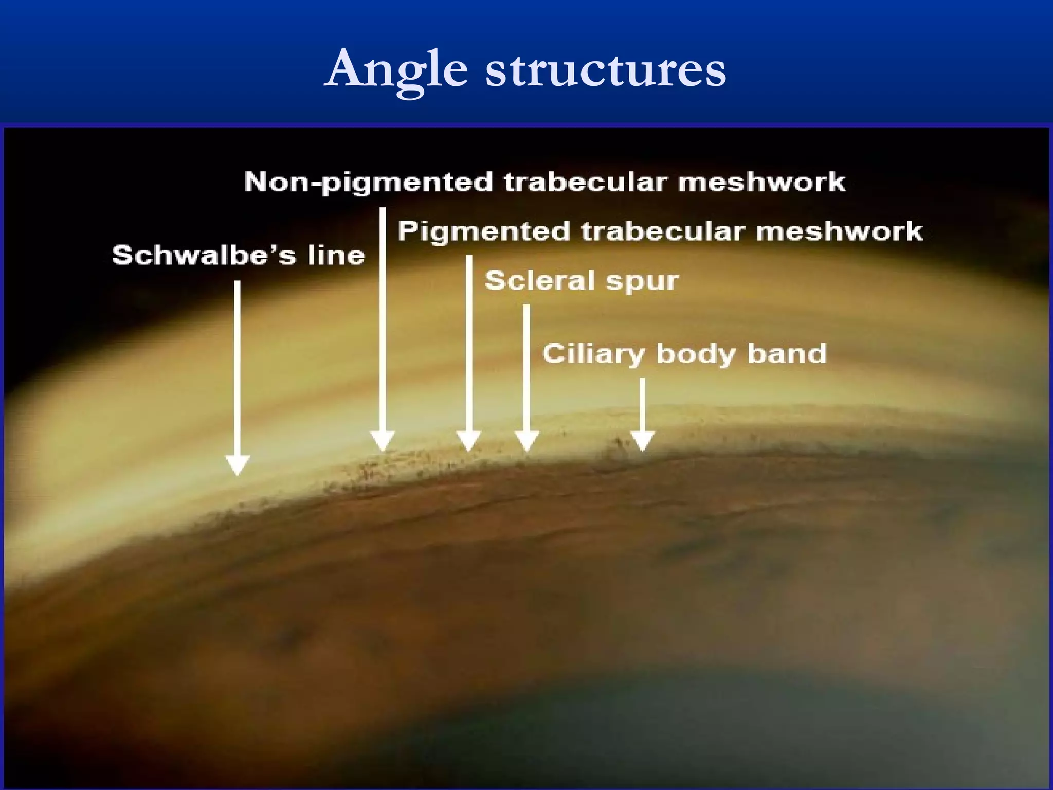 Gonioscopy presentation | PPT