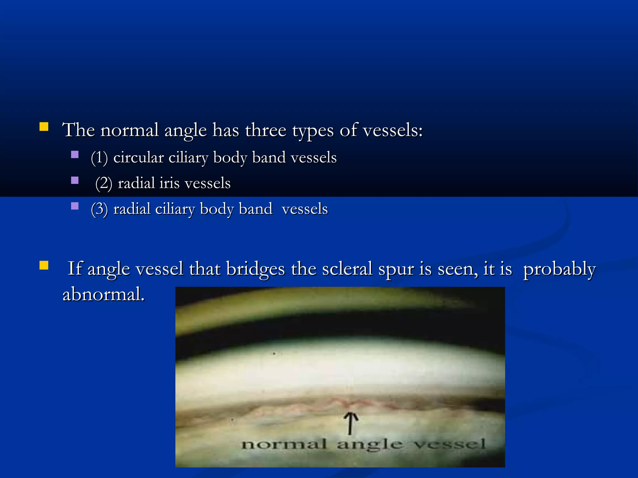 Gonioscopy presentation | PPT