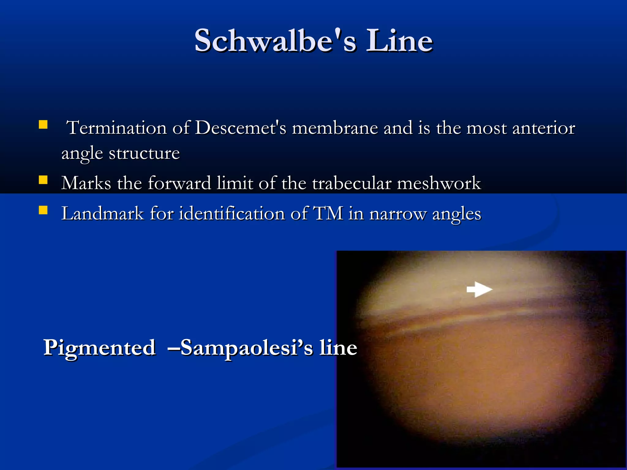 Gonioscopy presentation | PPT