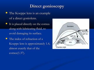 Gonioscopy presentation | PPT