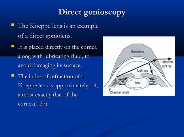 Gonioscopy presentation | PPT