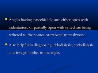 Gonioscopy presentation | PPT