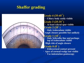 Gonioscopy presentation | PPT