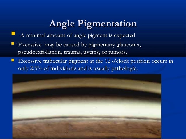 Gonioscopy presentation