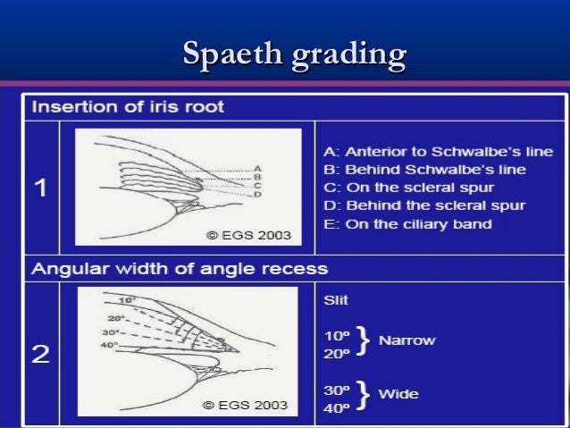 Gonioscopy presentation