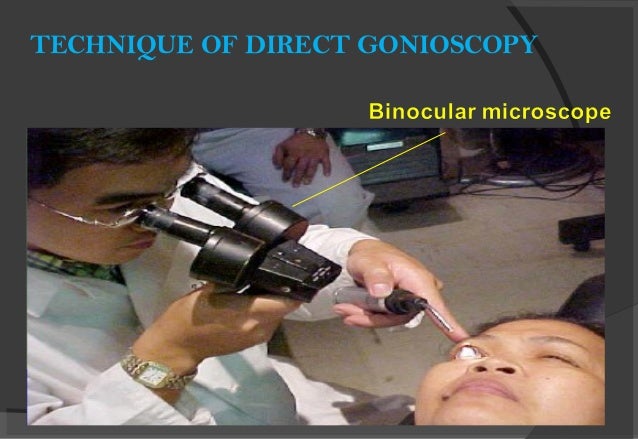 GONIOSCOPY by
