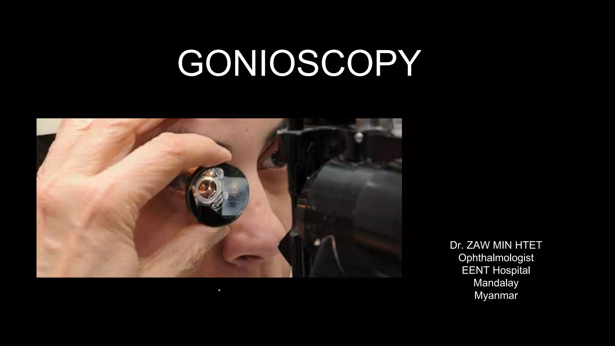 GONIOSCOPY by Dr. ZAW MIN HTET (OPHTHALMOLOGIST) | PPTX