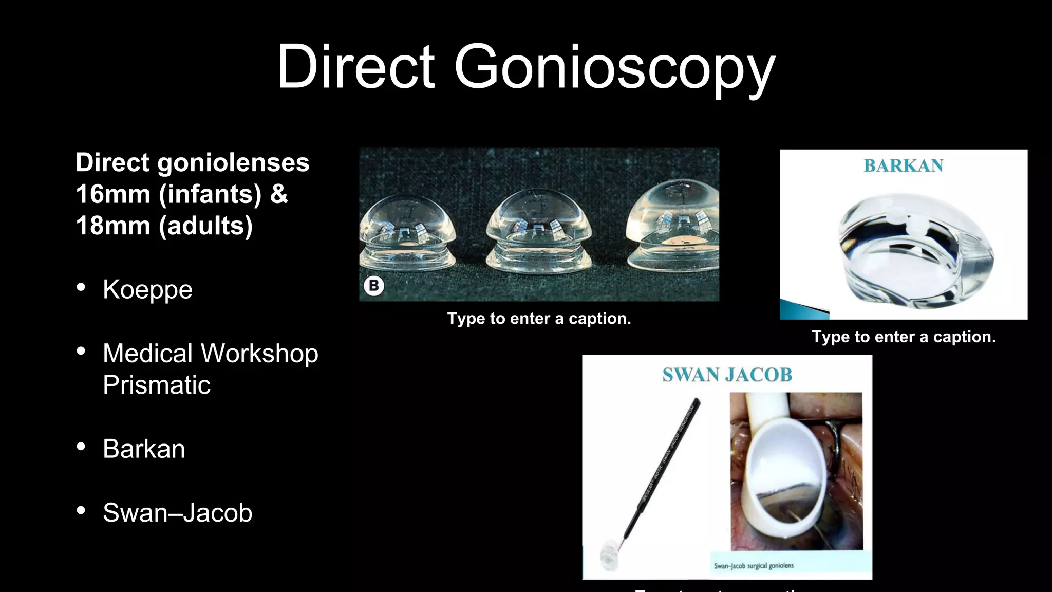 GONIOSCOPY by Dr. ZAW MIN HTET (OPHTHALMOLOGIST) | PPTX