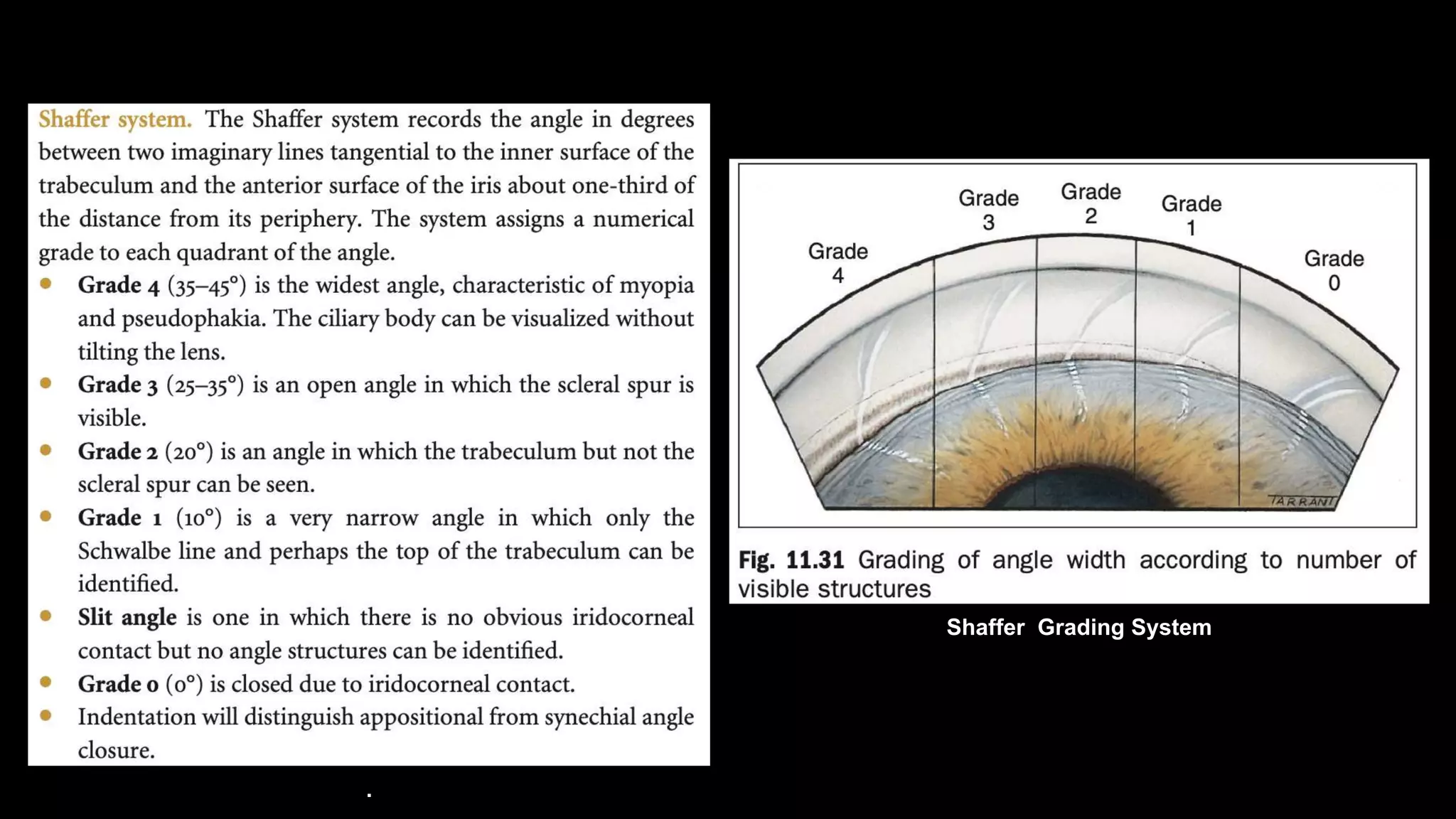 GONIOSCOPY by Dr. ZAW MIN HTET (OPHTHALMOLOGIST) | PPTX