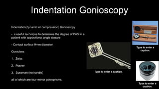 GONIOSCOPY by Dr. ZAW MIN HTET (OPHTHALMOLOGIST) | PPTX