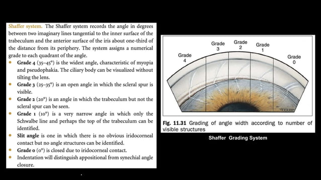 GONIOSCOPY by Dr. ZAW MIN HTET (OPHTHALMOLOGIST) | PPTX | Eye and ...