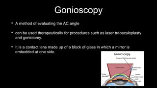 GONIOSCOPY by Dr. ZAW MIN HTET (OPHTHALMOLOGIST) | PPTX