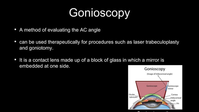 GONIOSCOPY by Dr. ZAW MIN HTET (OPHTHALMOLOGIST) | PPTX | Eye and Vision Conditions | Diseases ...
