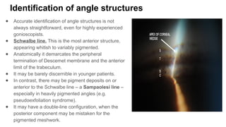 goniscopy.. power point presentation for opthalmology resident | PPT ...