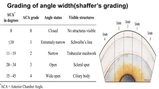 goniscopy.. power point presentation for opthalmology resident | PPT ...