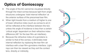 goniscopy.. power point presentation for opthalmology resident | PPT
