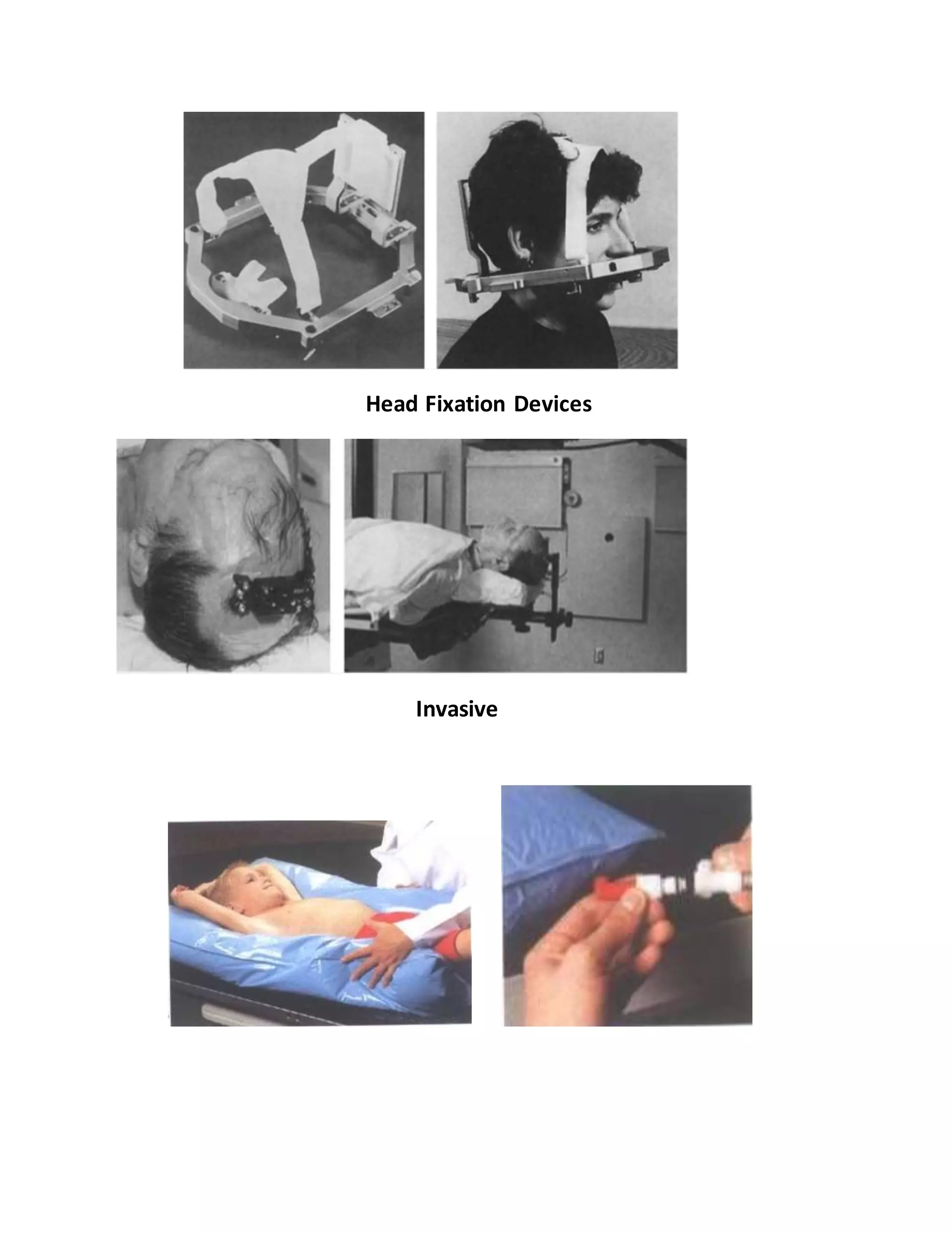 immobilising devices used in radiotherapy | DOCX