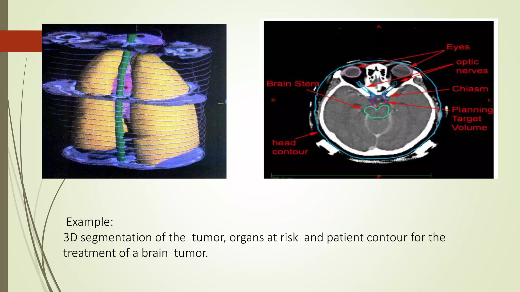 PATIENT DATA ACQUISITION USING MRI IMAGING MODALTIES | PPTX | 3-D ...