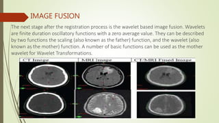PATIENT DATA ACQUISITION USING MRI IMAGING MODALTIES | PPTX | 3-D Graphics | Computer Software ...