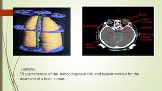 PATIENT DATA ACQUISITION USING MRI IMAGING MODALTIES | PPTX
