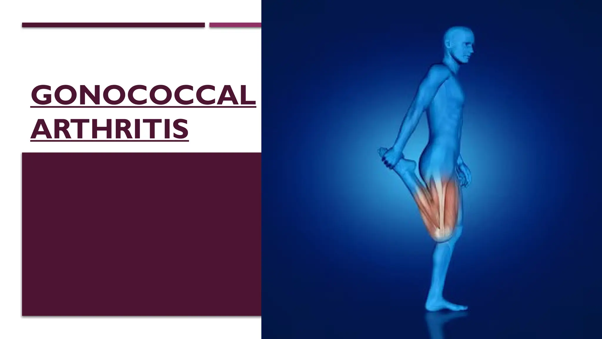 Orthopedic and Infectious Bone Conditions: Sprains, Tuberculosis ...