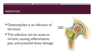 Orthopedic and Infectious Bone Conditions: Sprains, Tuberculosis ...