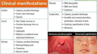 Gonococcal infection | PPTX